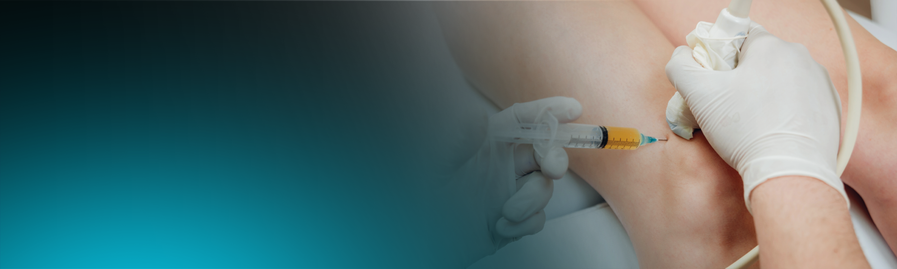 Platelet-Rich Plasma (PRP) Injections | Envision Medical Imaging